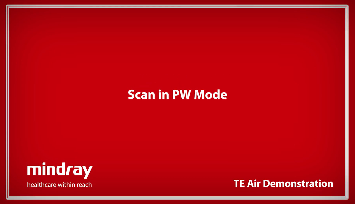 Mindray TE Air Tutorial - Scan in Pulse Wave (PW) Mode – Mindray Online ...