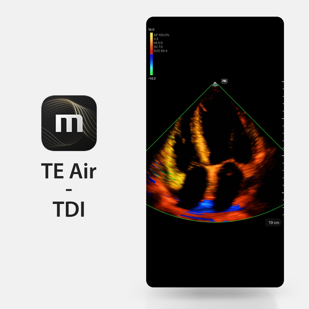 TDI - TE Air Cardiac Examinations App – Mindray Online Store