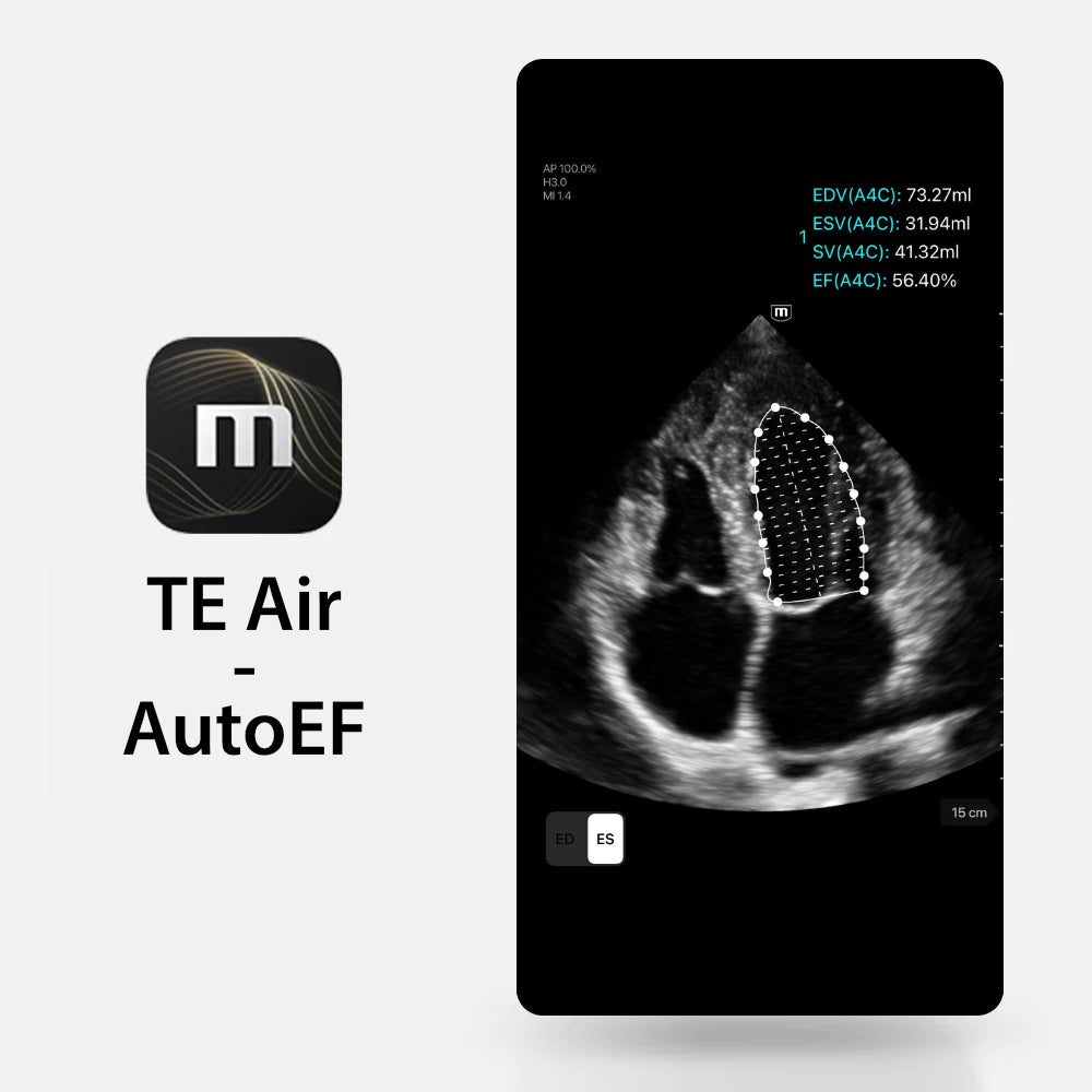 AutoEF - TE Air Left Heart Function Examination App – Mindray Online Store